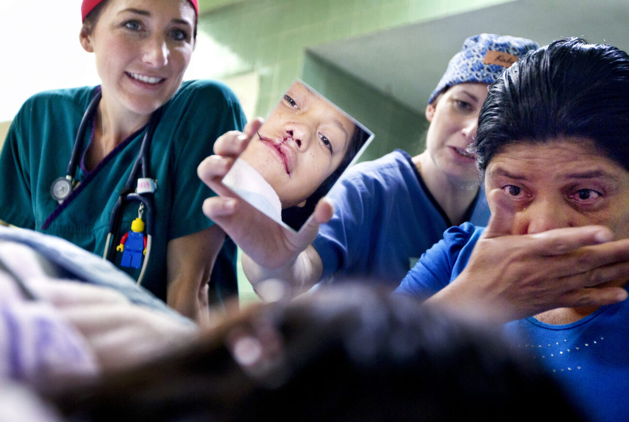 Om Operation Smile – Operation Smile Norge